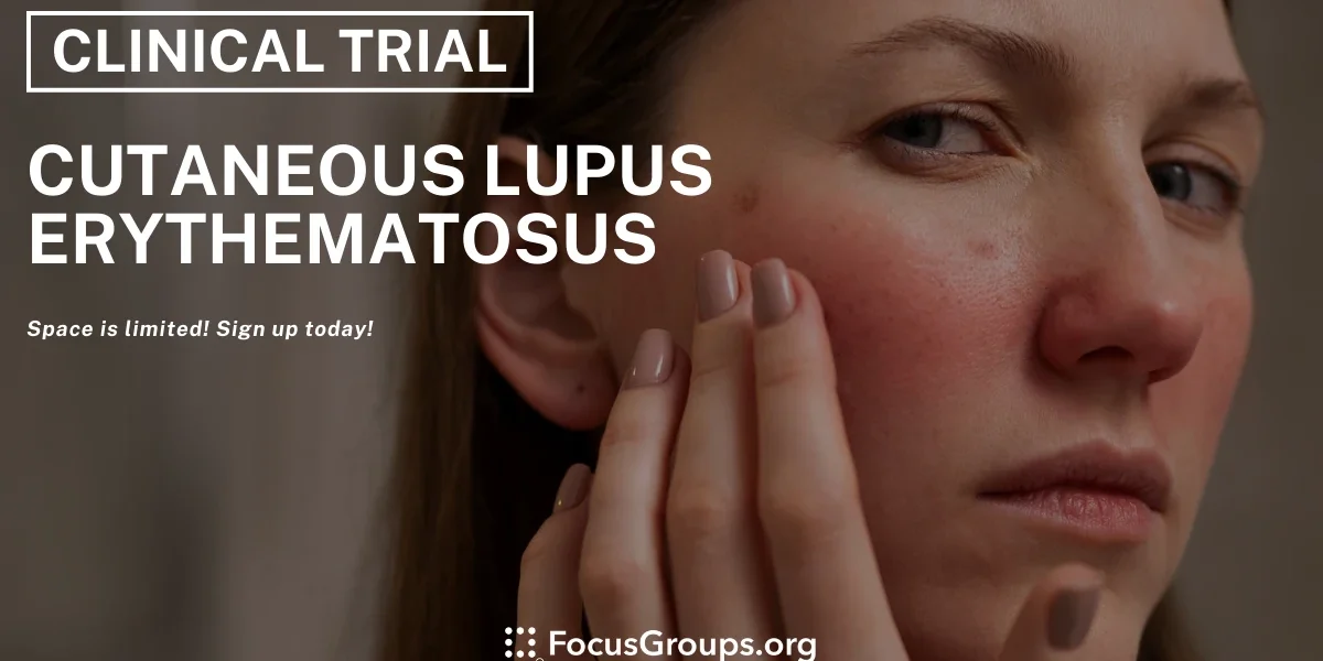 Clinical Trial on Cutaneous Lupus Erythematosus - Varies - 03/08/2024