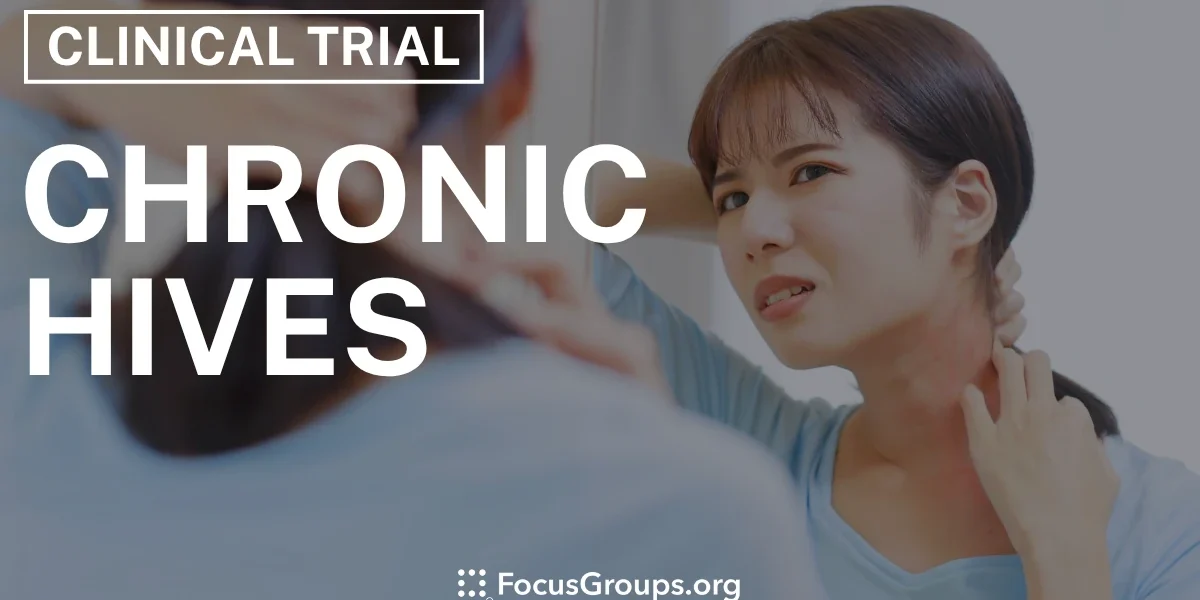 Clinical Trial on Chronic Hives