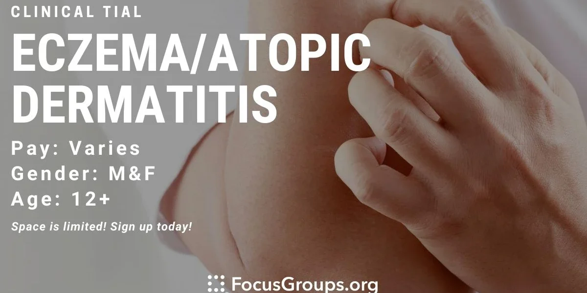 Clinical Trial on Eczema/Atopic Dermatitis - TBD - 12/09/2021